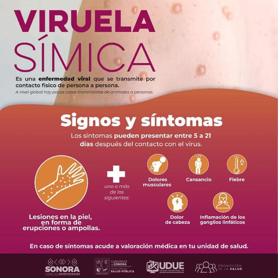 Salud en alerta: confirman dos casos de viruela símica en Salta.- UTUTO